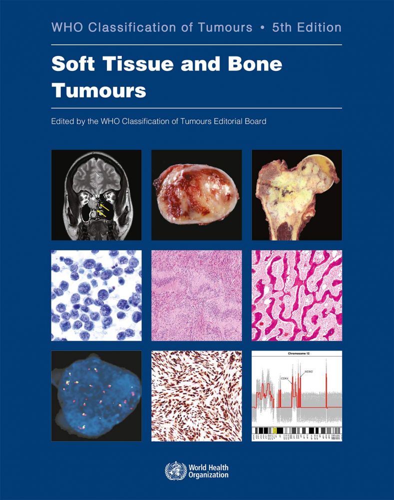 Livraria e Editora Livromed Paulista - Soft Tissue and Bone Tumours WHO ... Livraria e Editora Livromed Paulista - Soft Tissue and Bone Tumours WHO ...